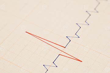 Cardio Graph stock photo. Image of illness, health, care - 4127780