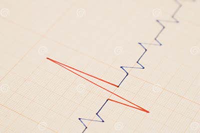 Cardio Graph stock photo. Image of illness, health, care - 4127780