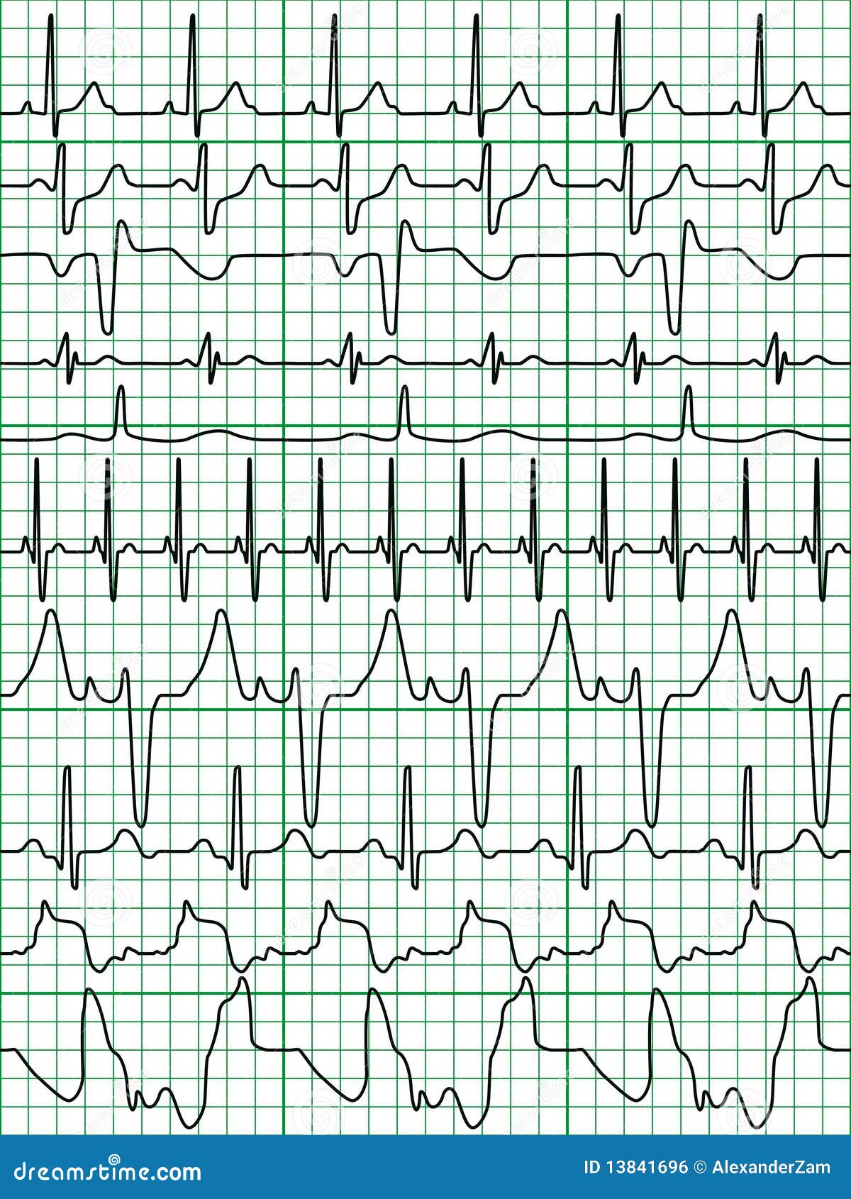 Cardiogram stock vector. Illustration of amplitude, cardiogram - 13841696
