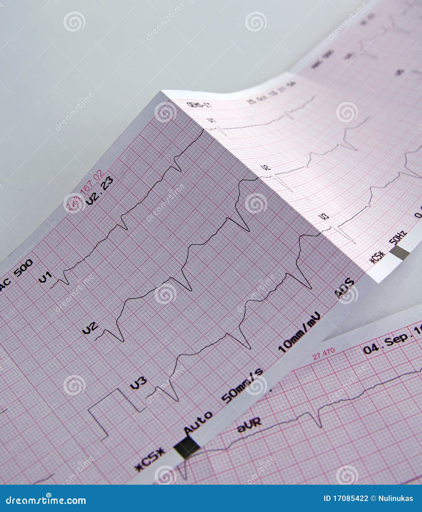 Cardiogram stock photo. Image of examination, beat, health - 17085422
