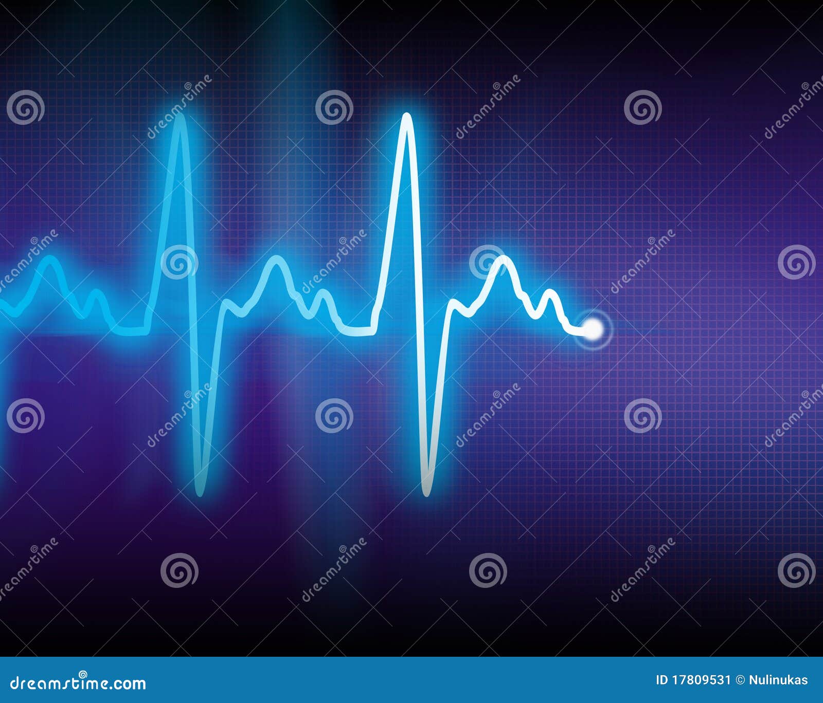 Cardiogram stock image. Image of diagnosis, cardio, cardiogram - 17809531
