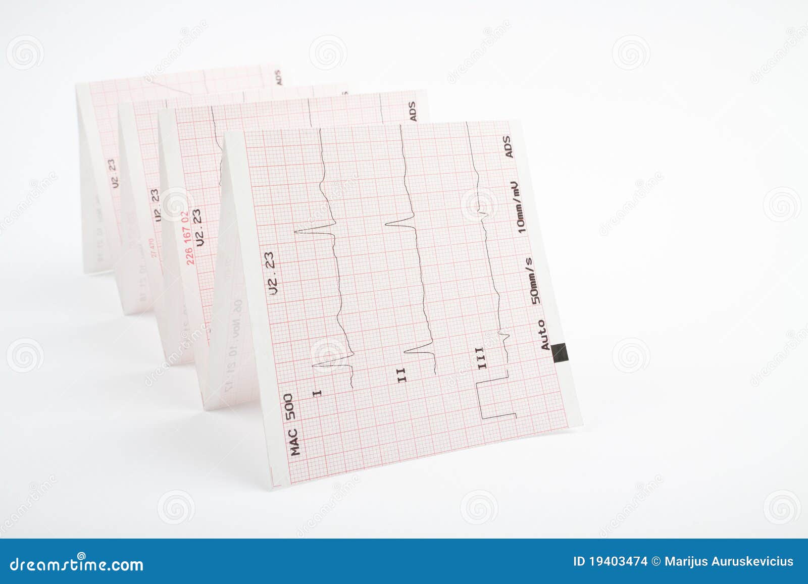 Cardiogram stock photo. Image of pattern, illness, cardiograph - 19403474