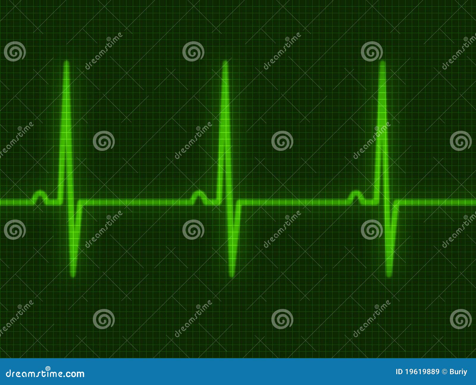 Cardiogram stock illustration. Illustration of cardiogram - 19619889