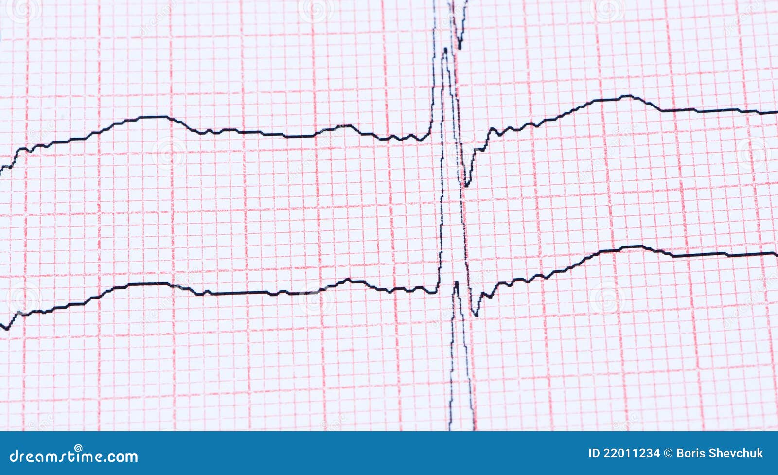 Cardiogram. foto de stock. Imagem de teste, eletrocardiograma - 22011234