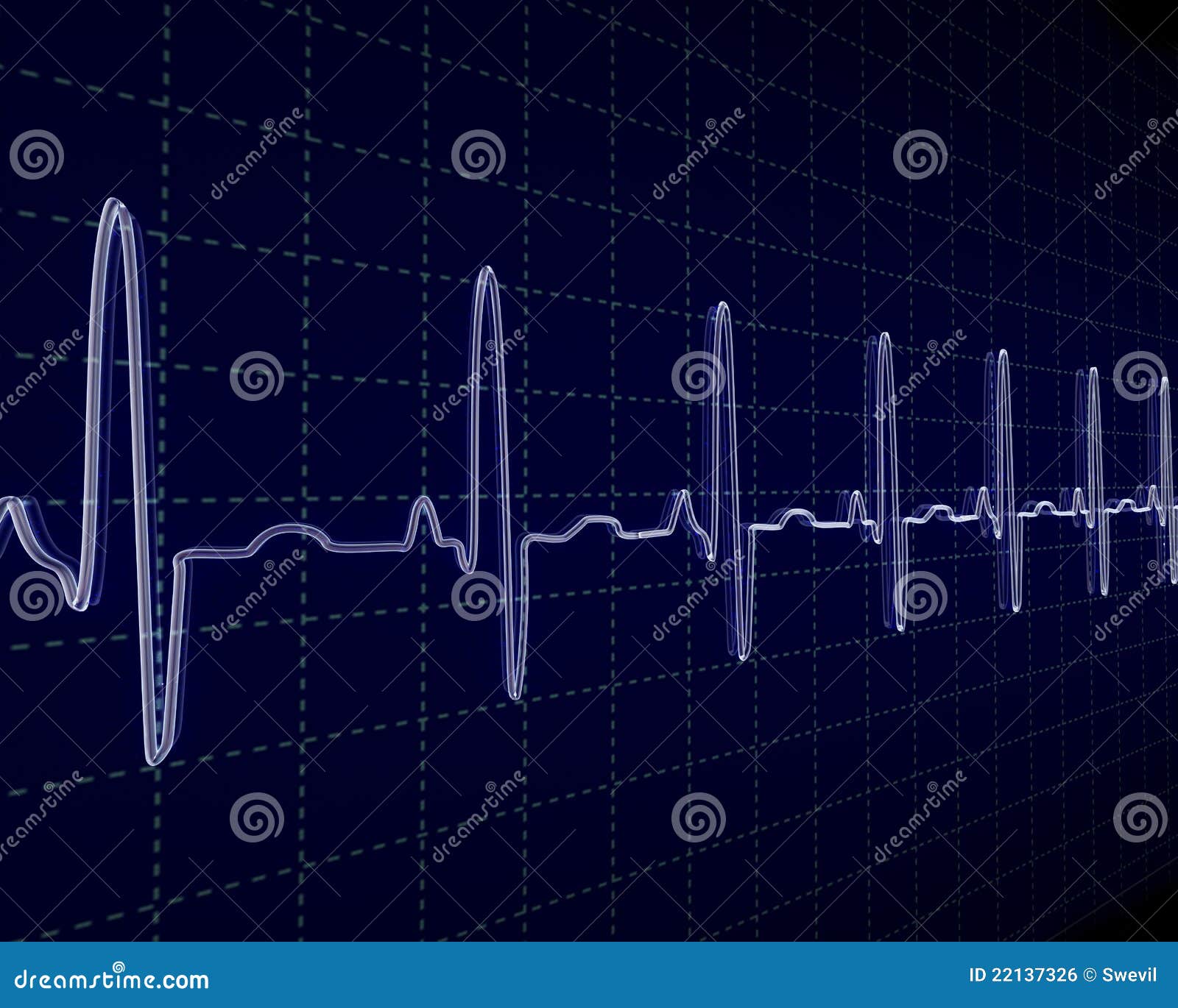 Cardiogram stock illustration. Illustration of monitor - 22137326