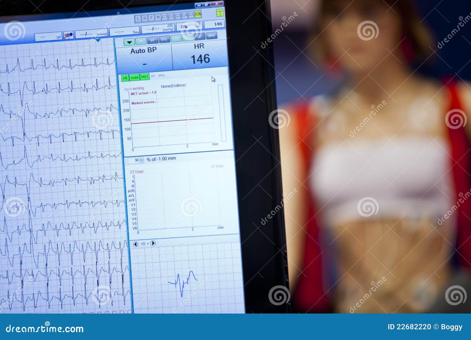 Cardiogram stock photo. Image of fitness, heartbeat, athlete - 22682220