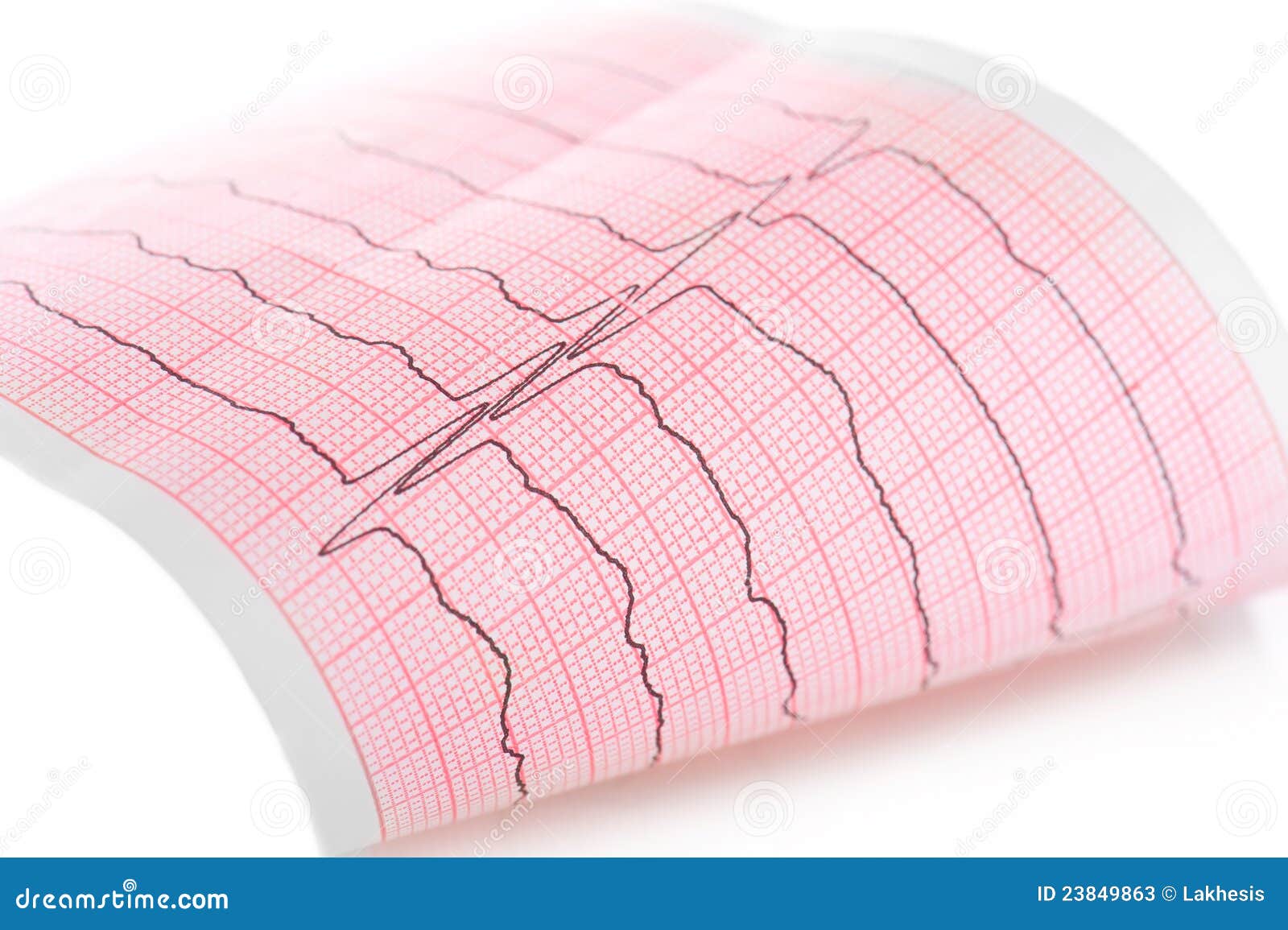 Cardiogram stock image. Image of diagnosis, diagram, electrocardiogram ...