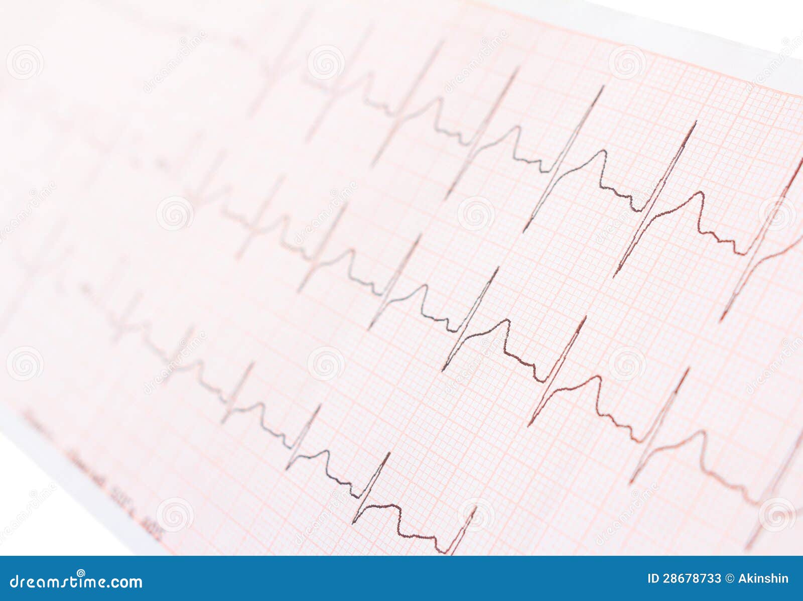 Cardiogram stock image. Image of graph, medicine, electrocardiograph ...