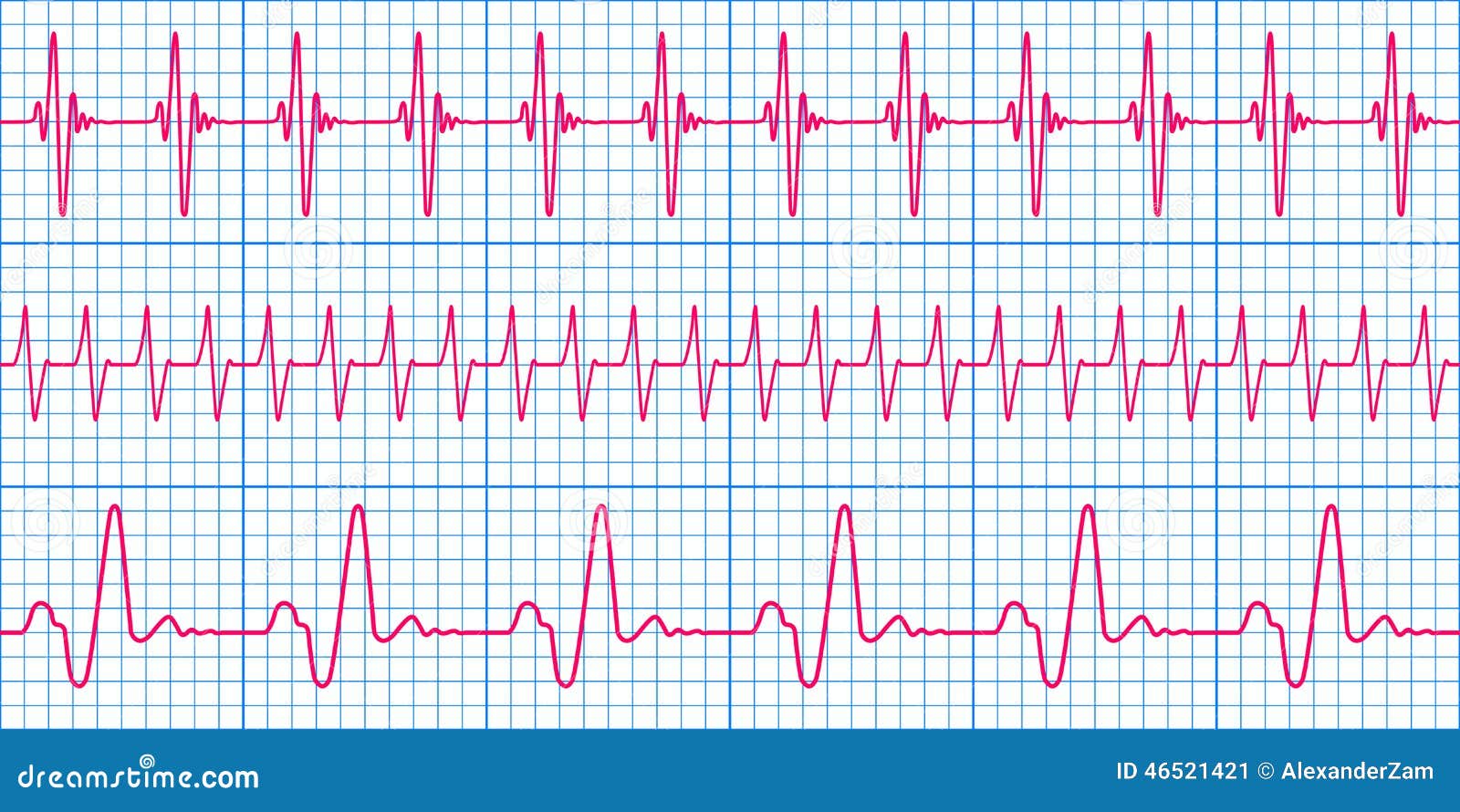 Cardiogram illustrazione vettoriale. Illustrazione di grafico - 46521421