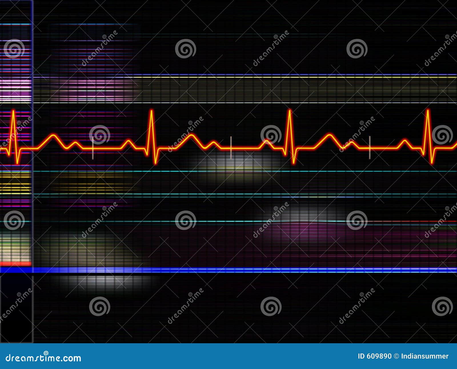 Cardiogram, Hope For Survival, Resuscitation Of Human Life, Pulse. Ekg ...