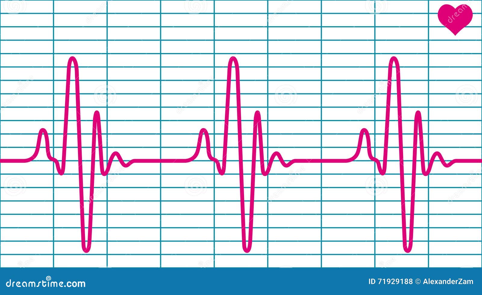 Cardiogram ilustración del vector. Ilustración de medicina - 71929188