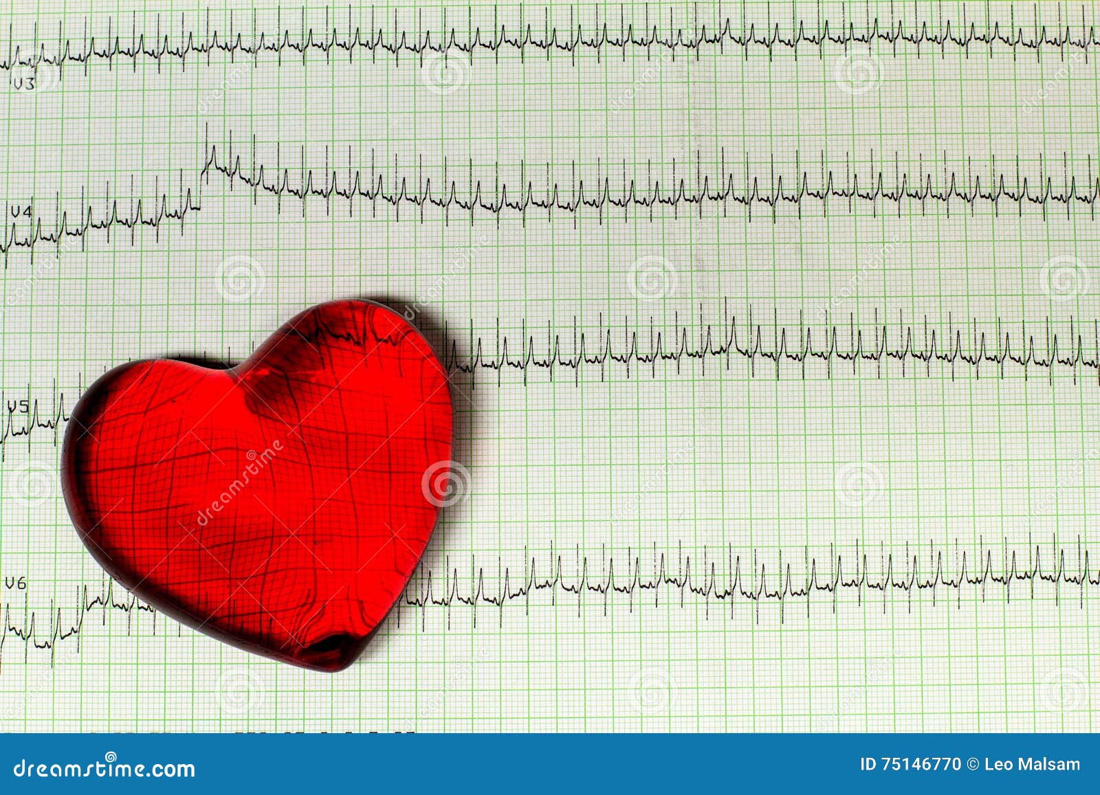 Cardiogram foto de archivo. Imagen de monitor, salud - 75146770