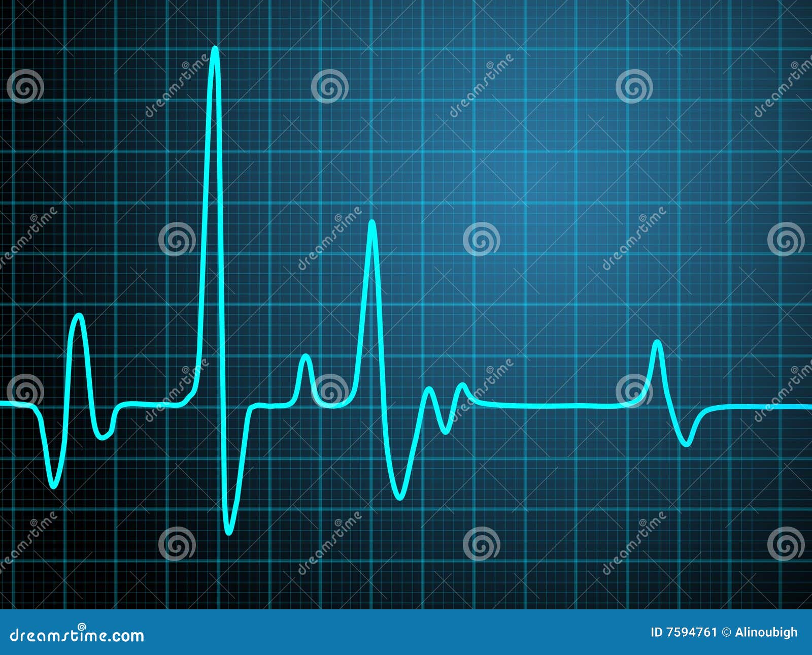Cardiogram stock image. Image of graph, cardioid, beating - 7594761