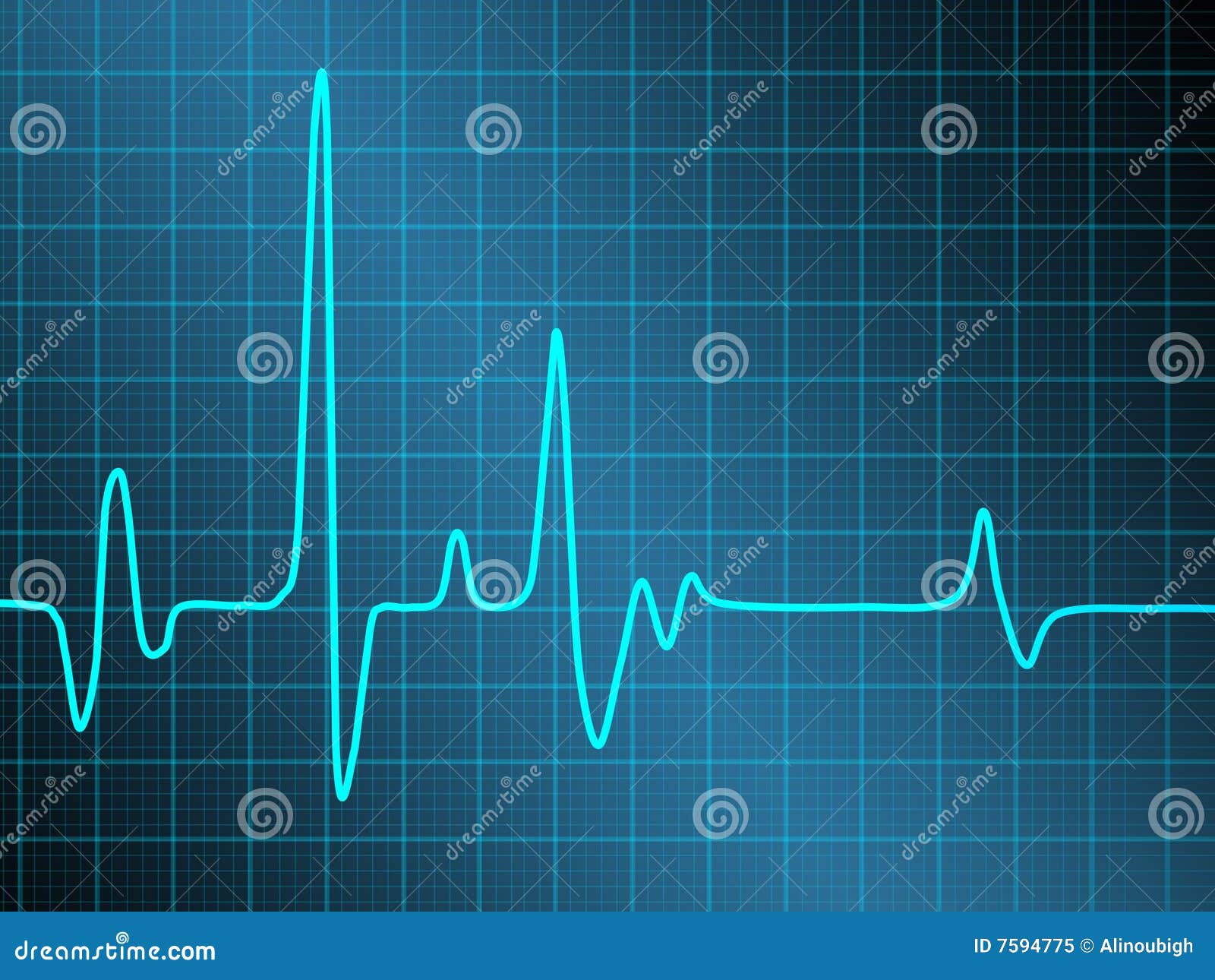 Cardiogram stock image. Image of examination, cardiogram - 7594775