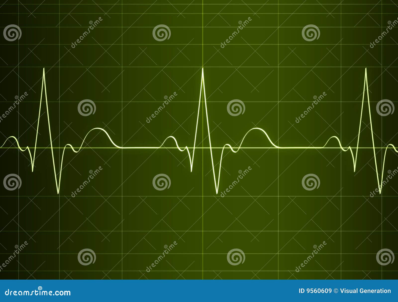 Cardiogram stock illustration. Illustration of cardiogram - 9560609