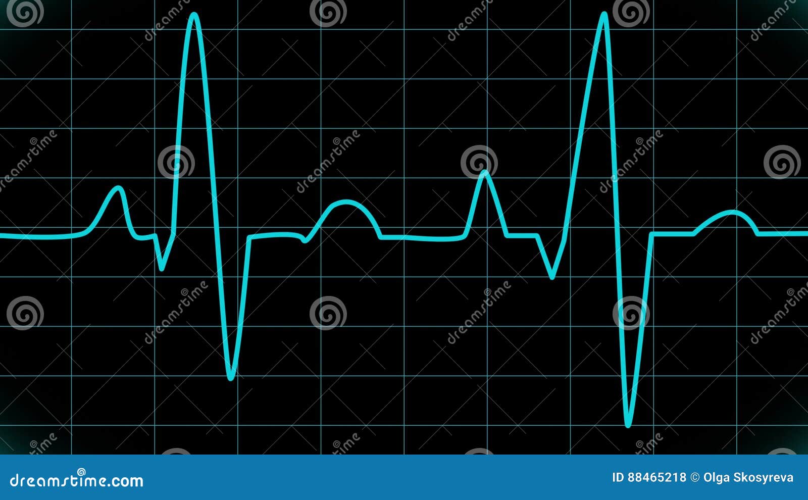 Cardiogram. Animated EKG Display. Stock Footage - Video of diagram ...