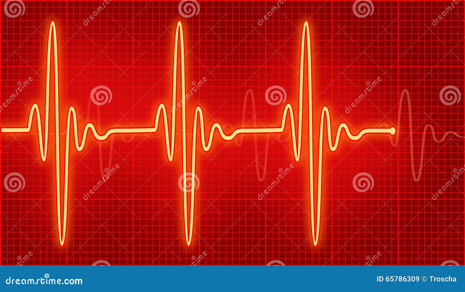 Cardiogram stock illustration. Illustration of frequency - 65786309