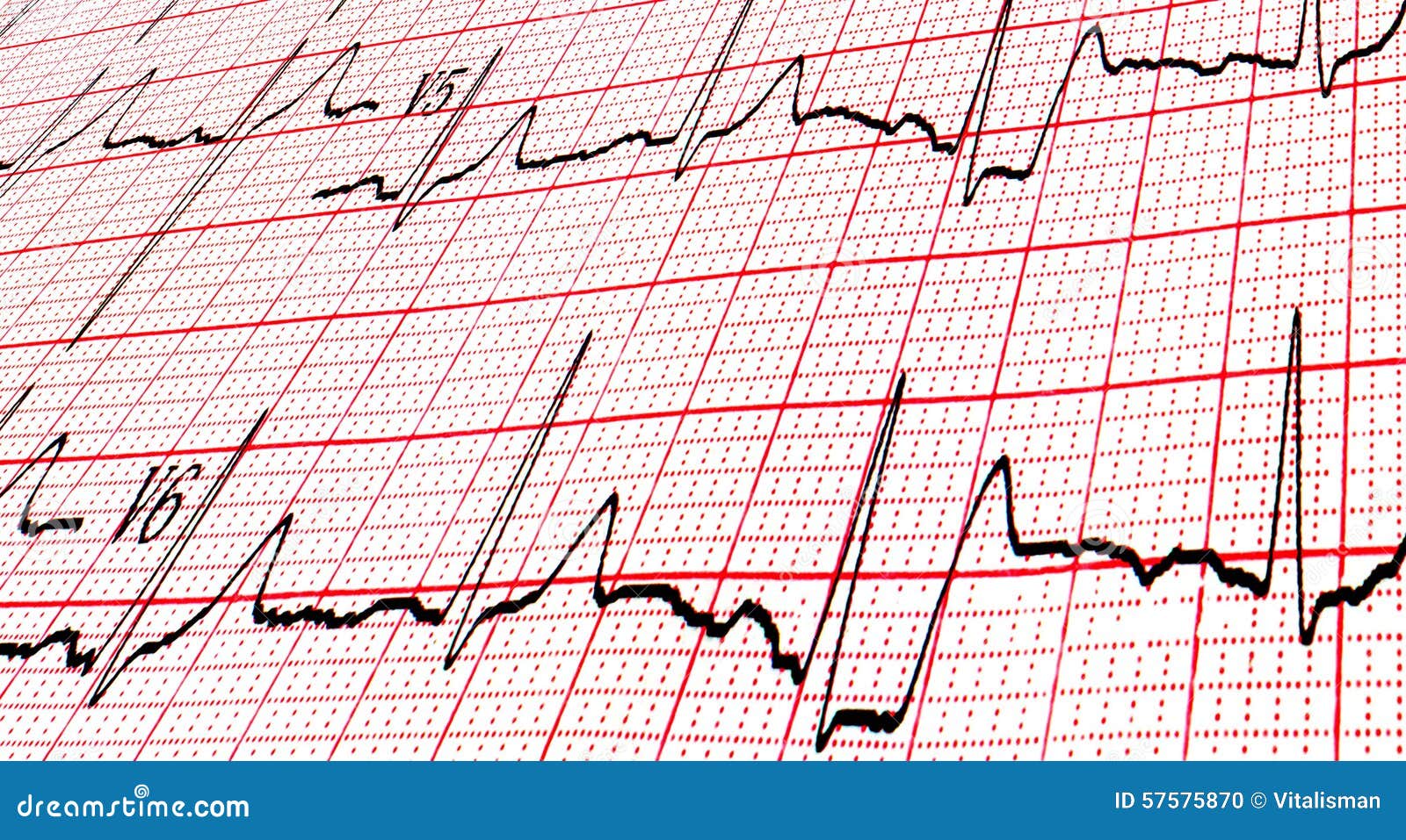 Cardiogram by CU stock photo. Image of curve, result - 57575870
