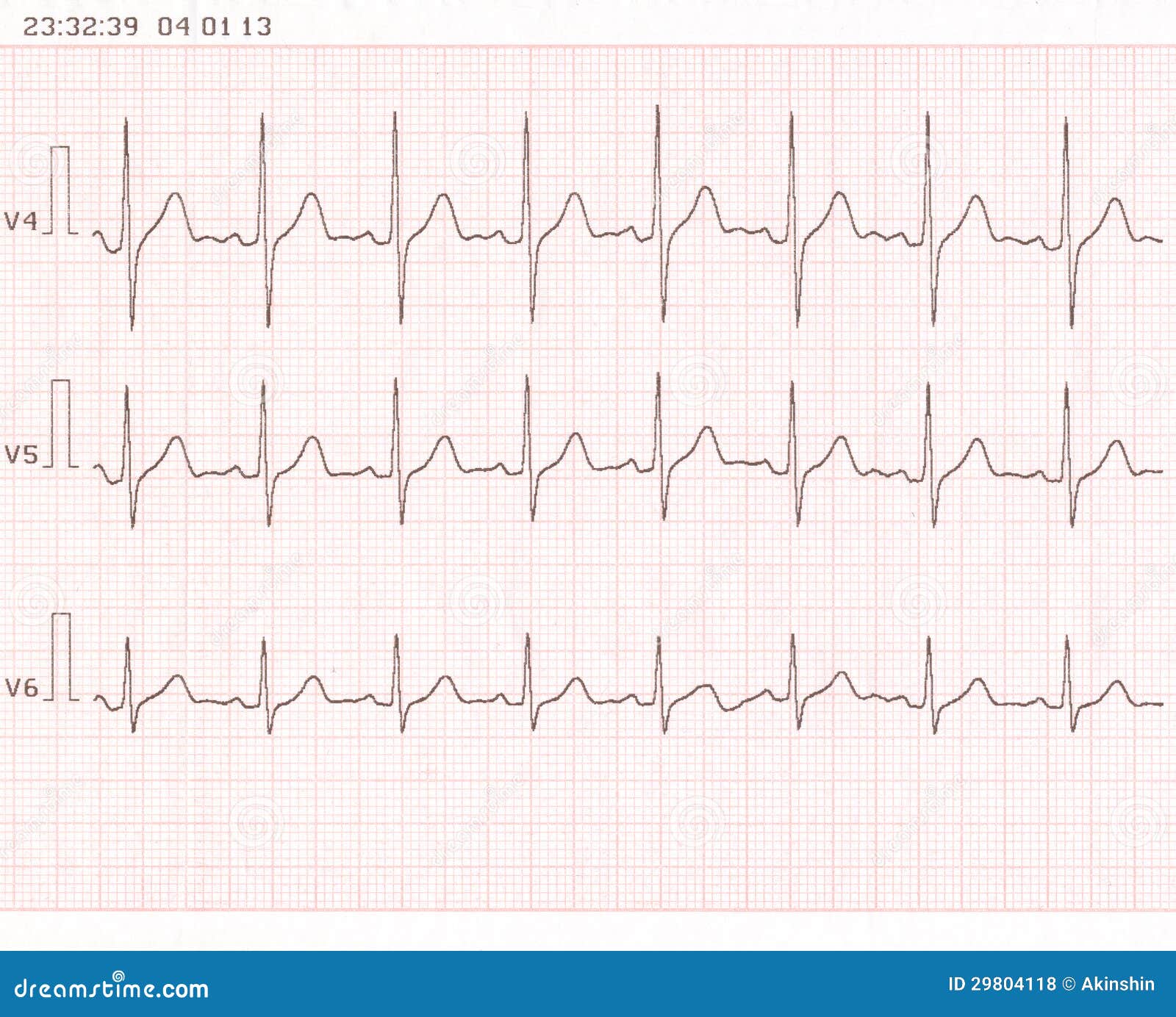 Cardiogram fotografia stock. Immagine di cardioide, oscilli - 29804118