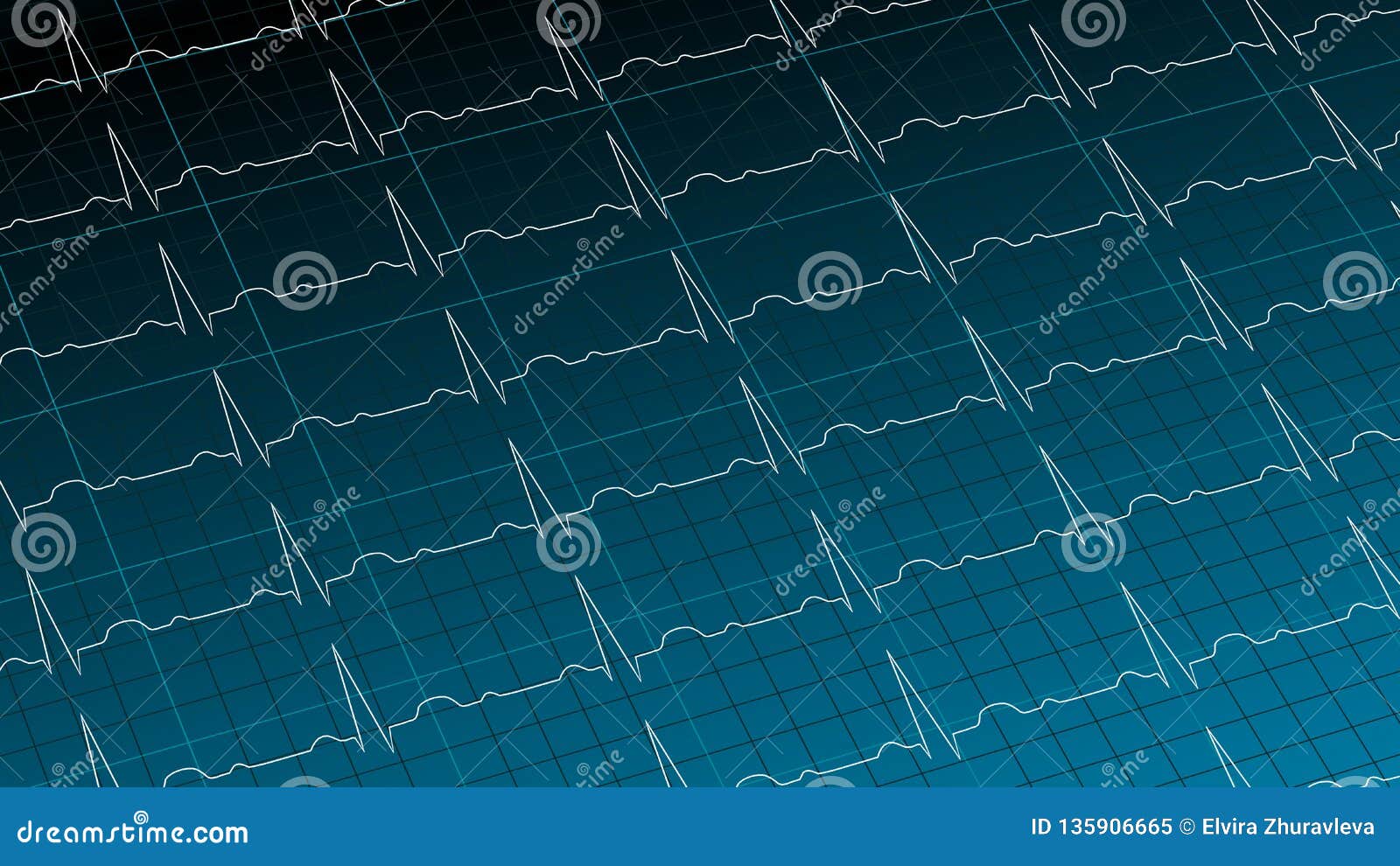 Cardiogram on Gradient Dark Blue Background 3D Illustration Stock ...