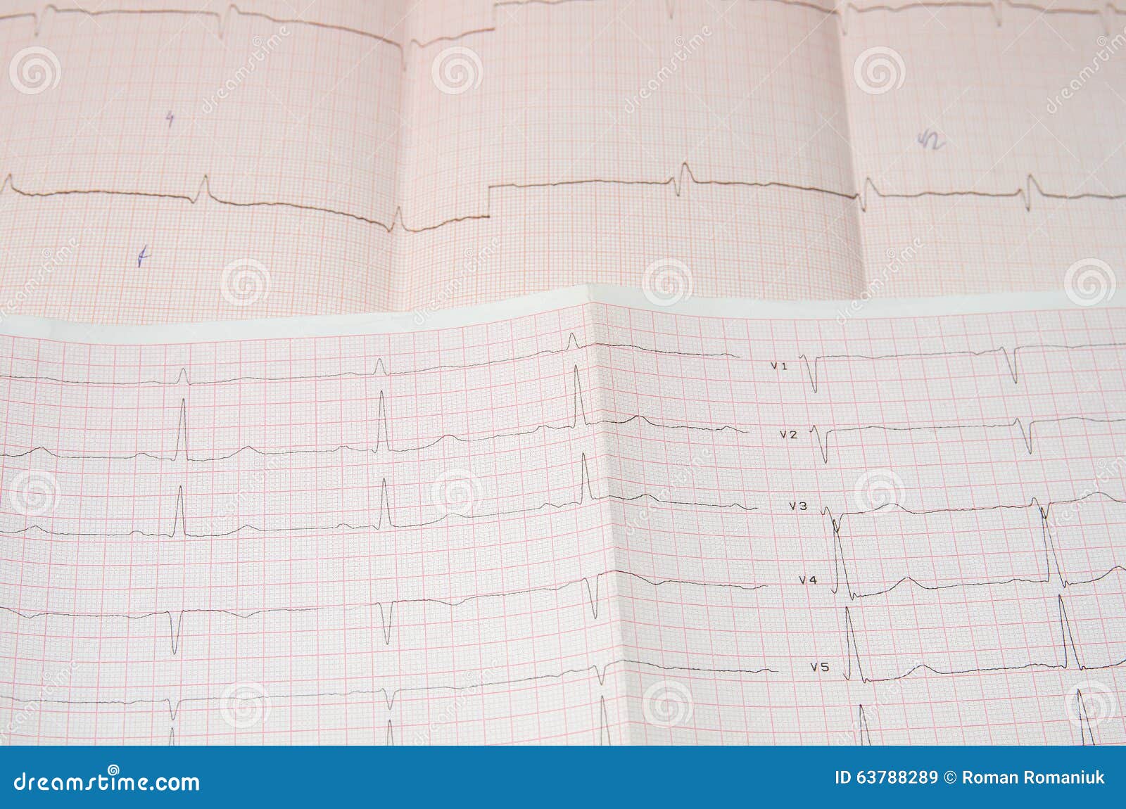 The cardiogram stock image. Image of blood, electrocardiogram - 63788289