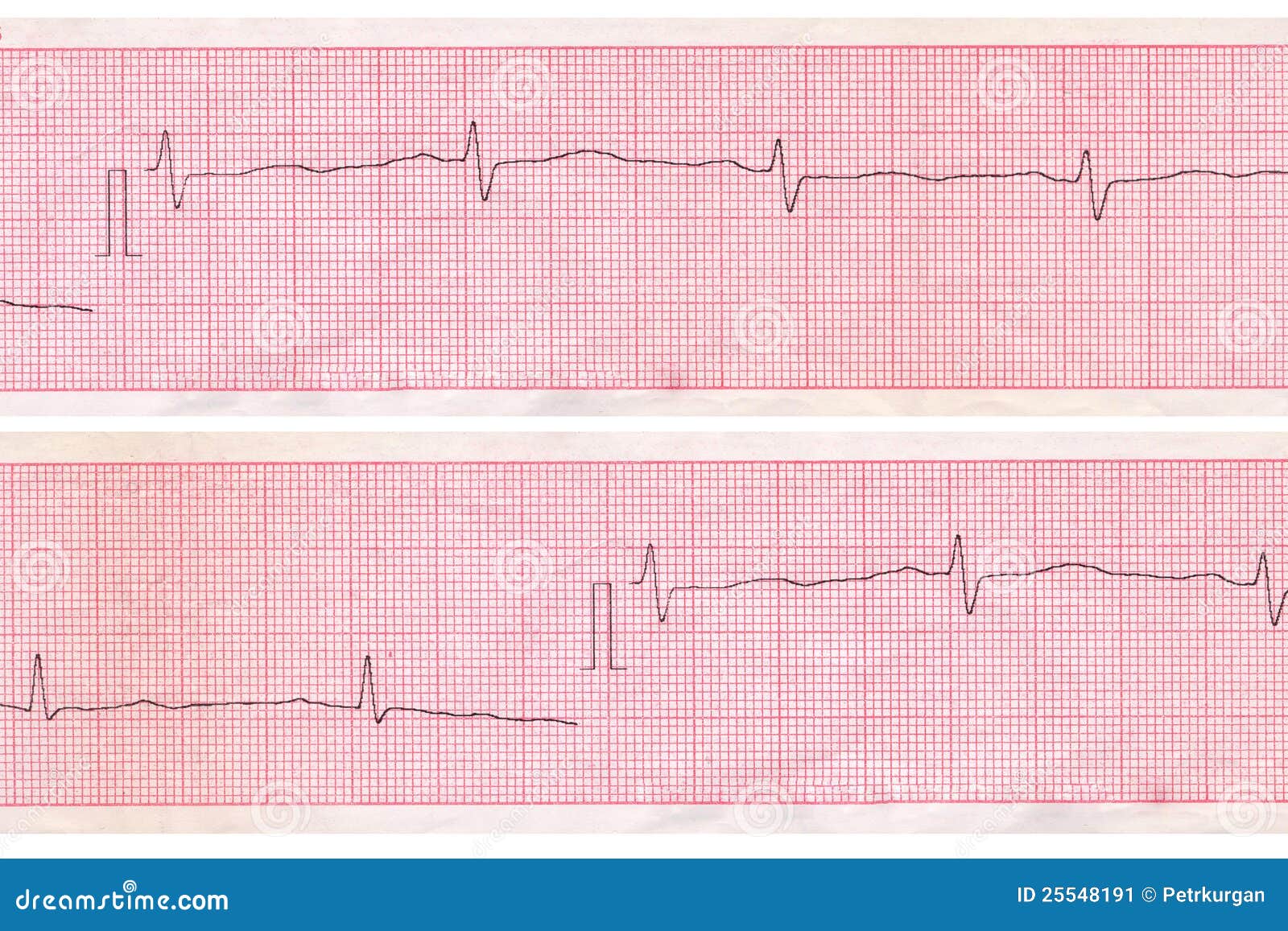 Cardiogram. Heart Analysis Scheme Stock Image - Image of test ...