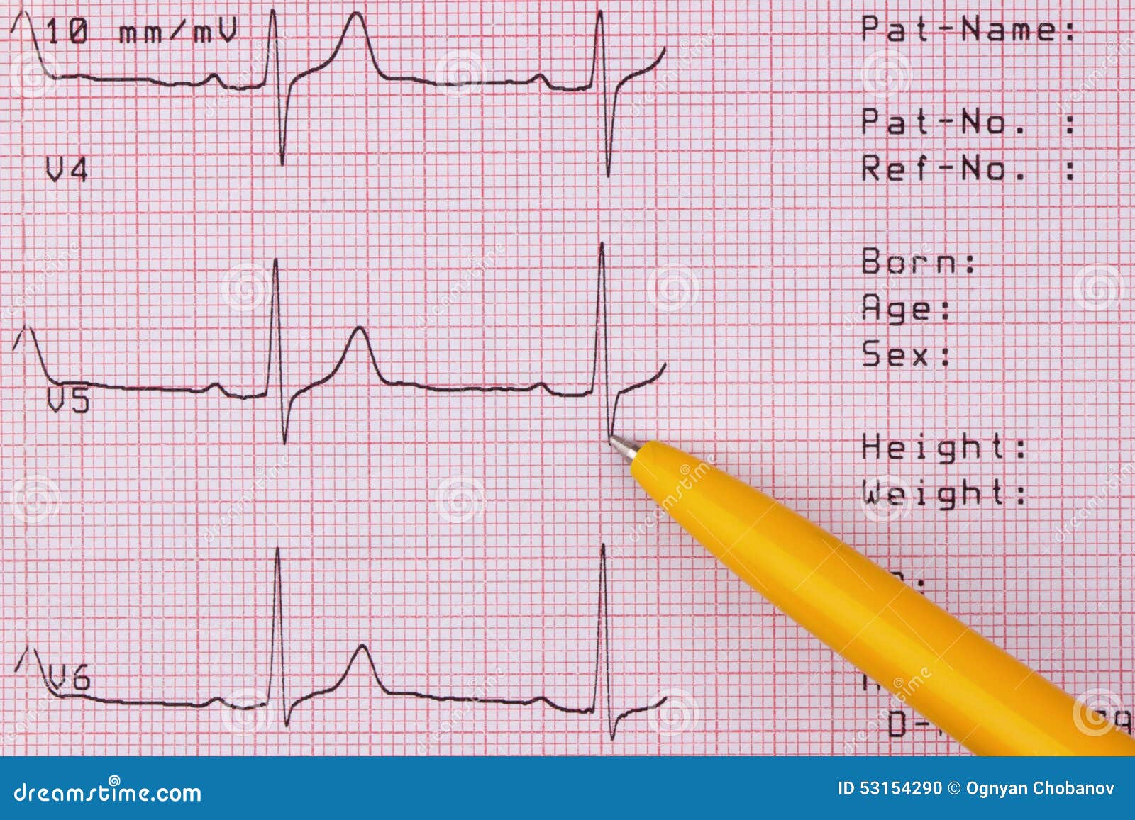 Cardiogram of heart beat stock photo. Image of healthcare - 53154290