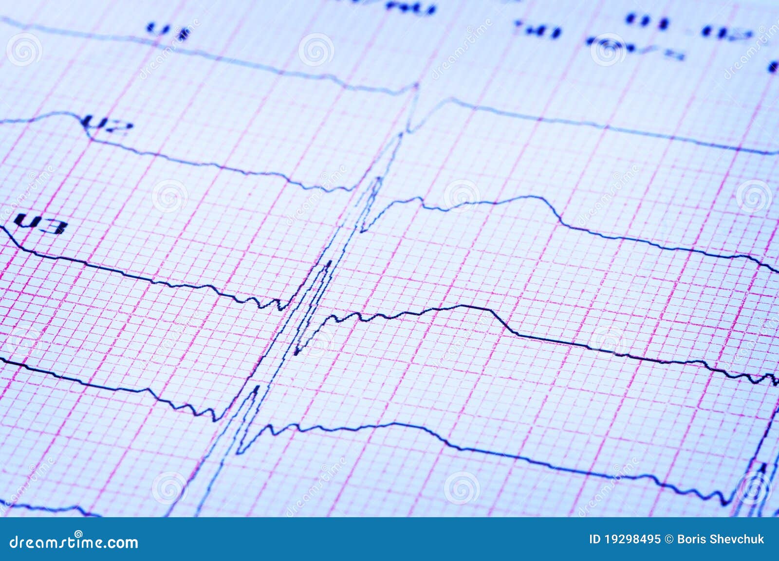 Cardiogram Of Heart On Paper Stock Image Image Of Graphic