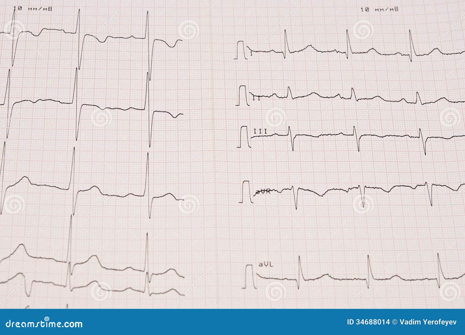 Cardiogram stock photo. Image of medical, chart, medicine - 34688014