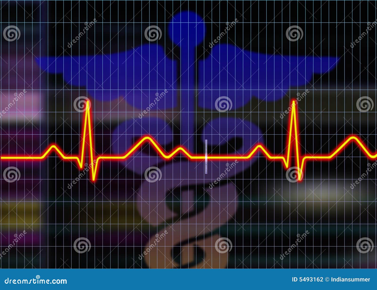 Cardiogram, Hope For Survival, Resuscitation Of Human Life, Pulse. Ekg ...