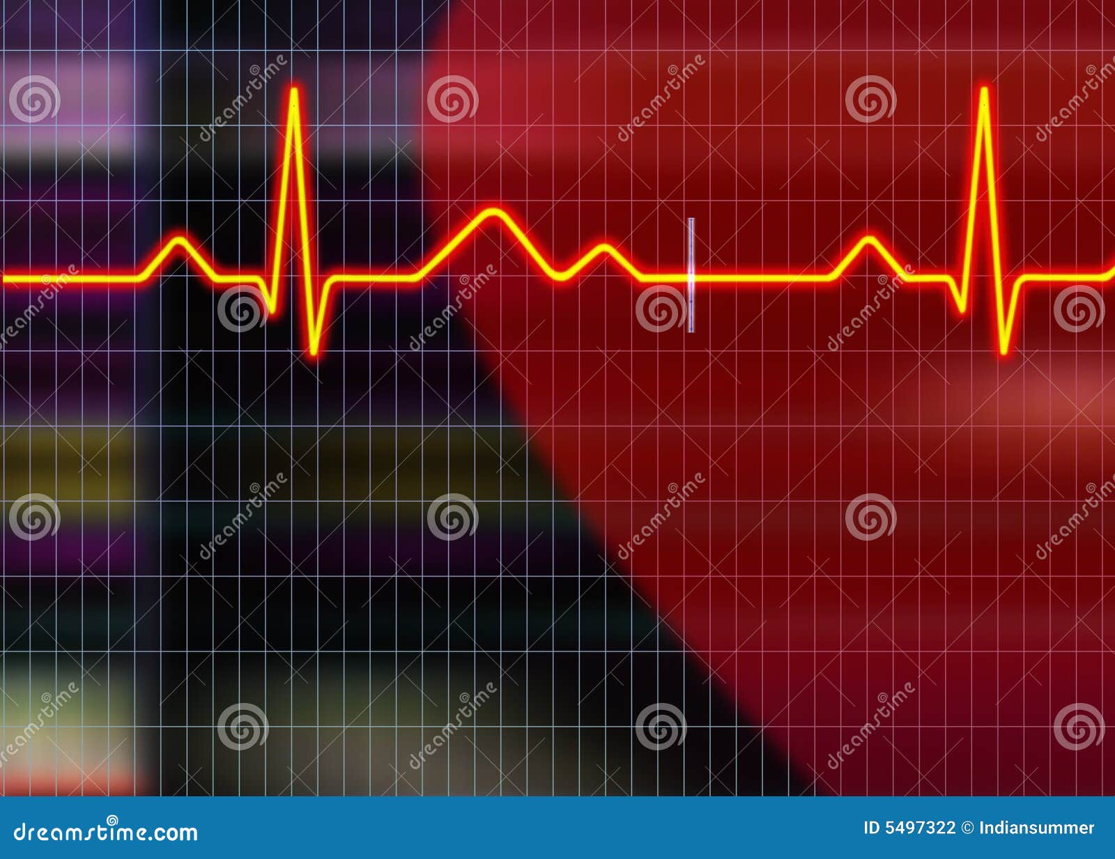 Cardiogram, Hope For Survival, Resuscitation Of Human Life, Pulse. Ekg ...