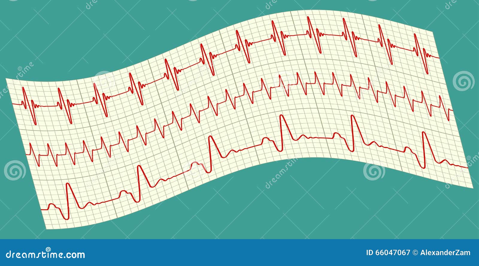 Cardiogram stock vector. Illustration of wave, medical - 66047067