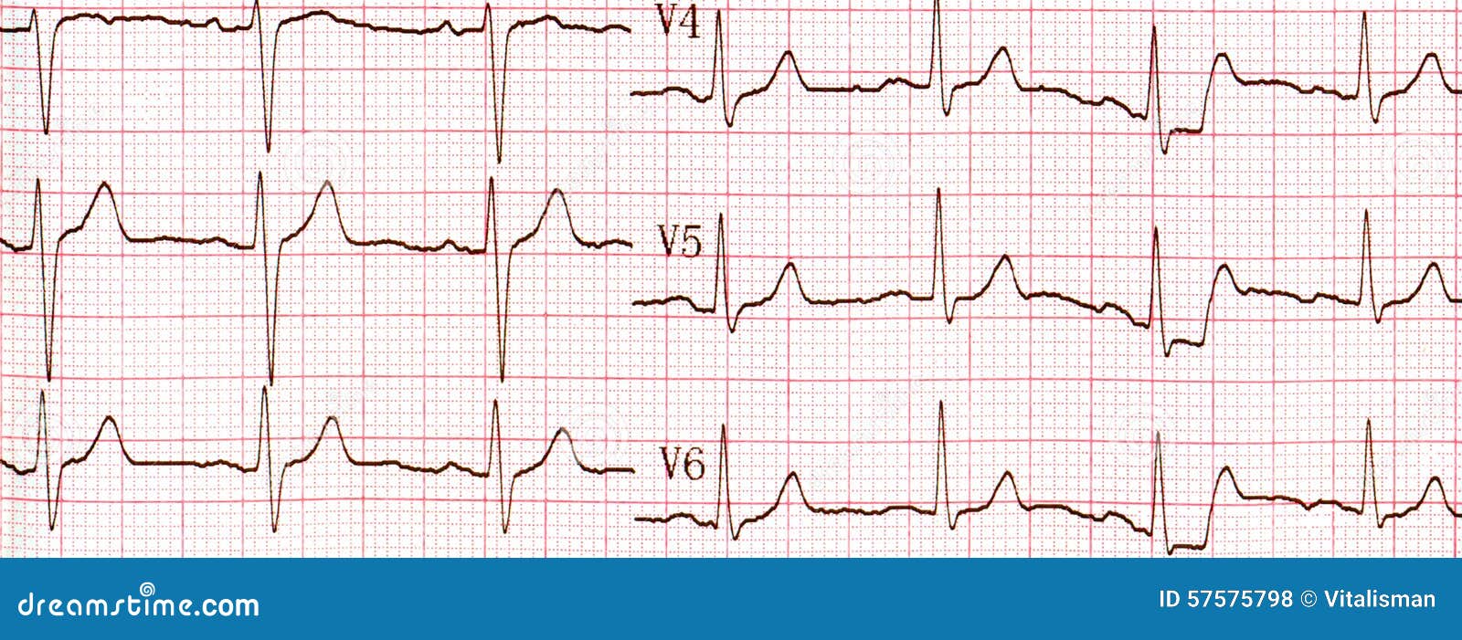 Cardiogram stock photo. Image of letter, profession, knock - 57575798