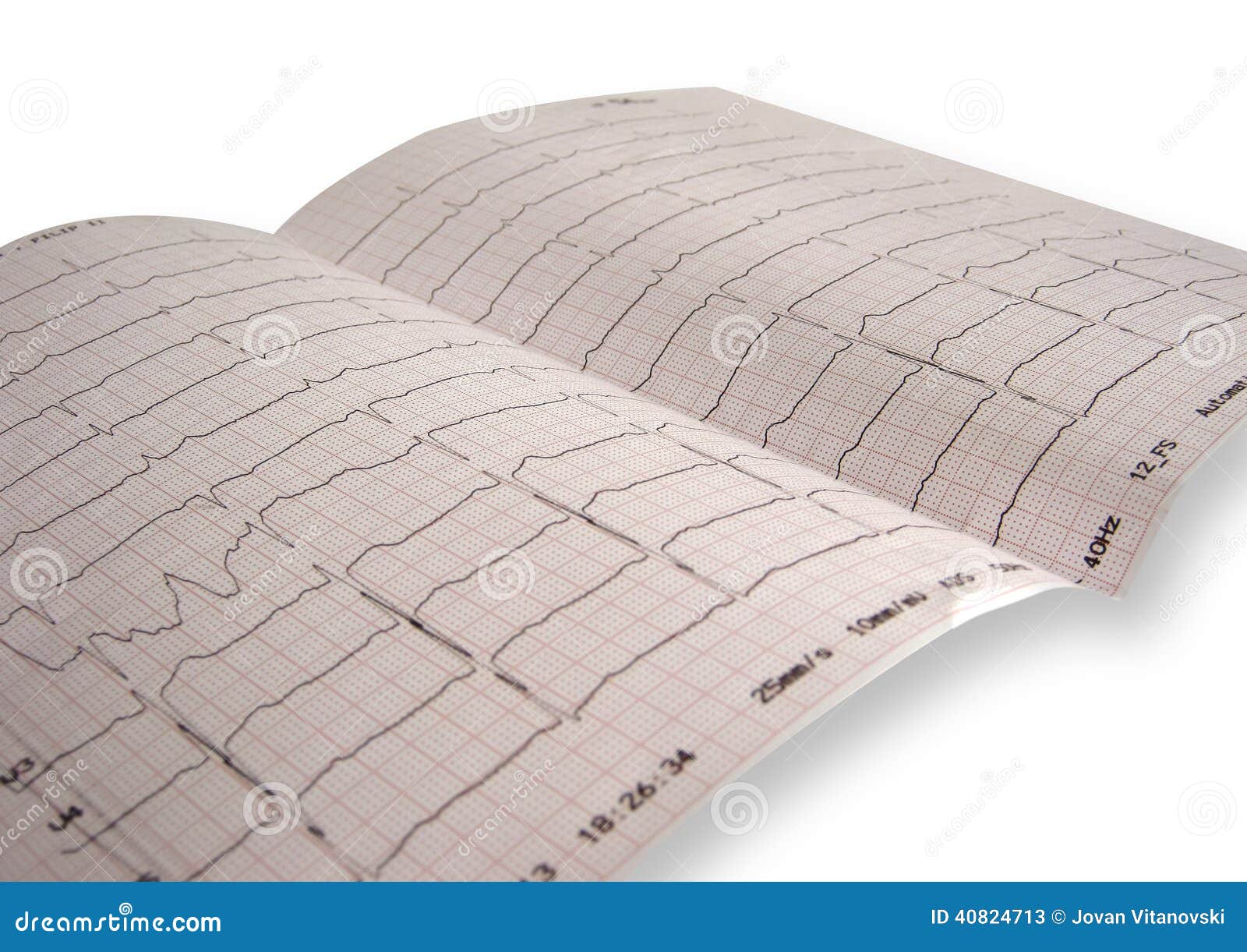 Cardiogram stock image. Image of detail, analysis, doctor - 40824713