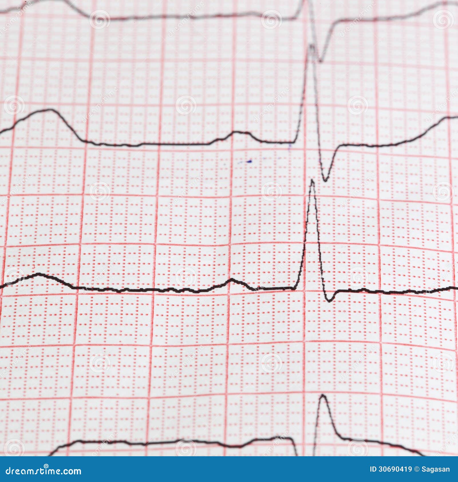 Cardiogram stock image. Image of graph, experiment, beauty - 30690419