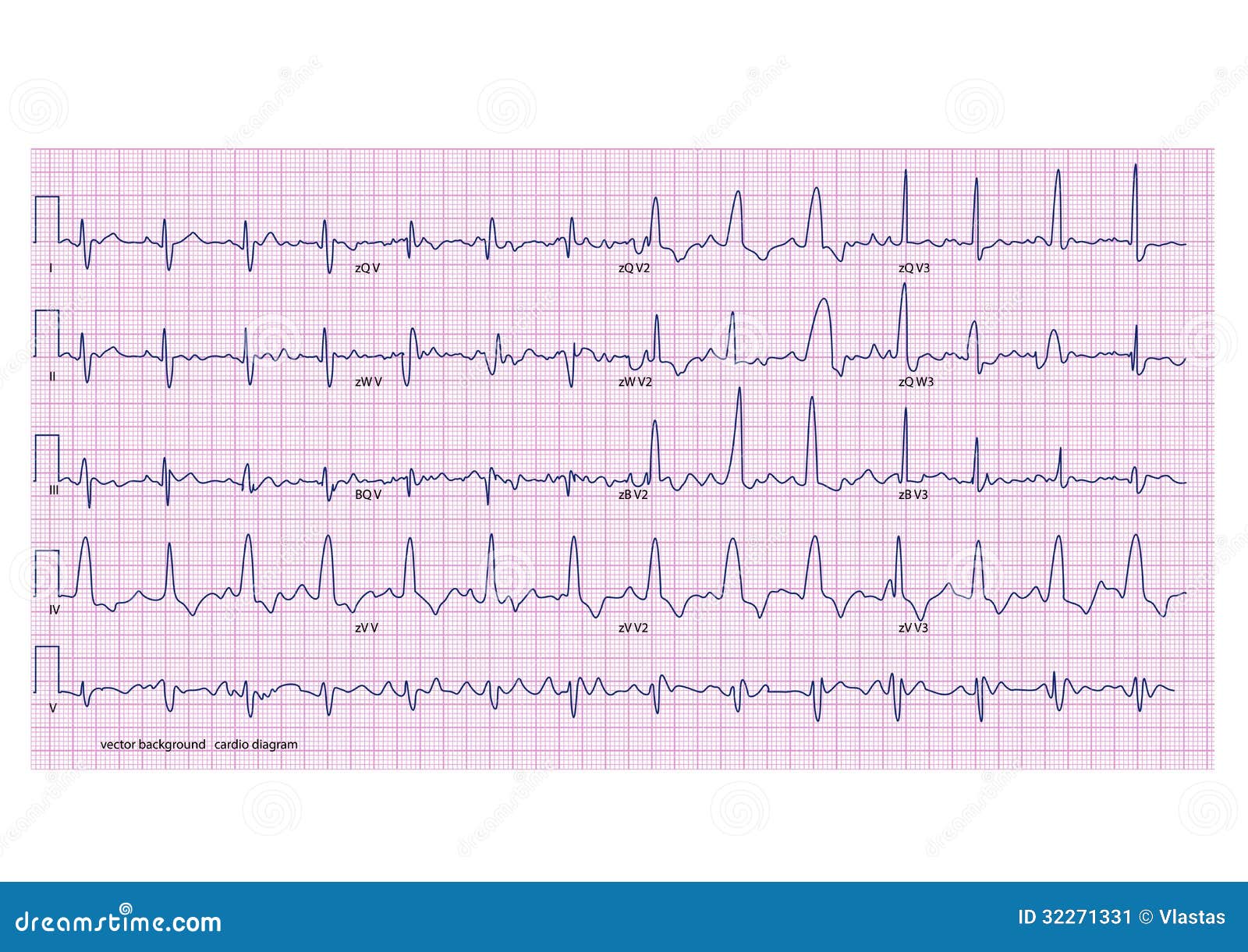 Cardiogram stock vector. Illustration of line, heartbeat - 32271331