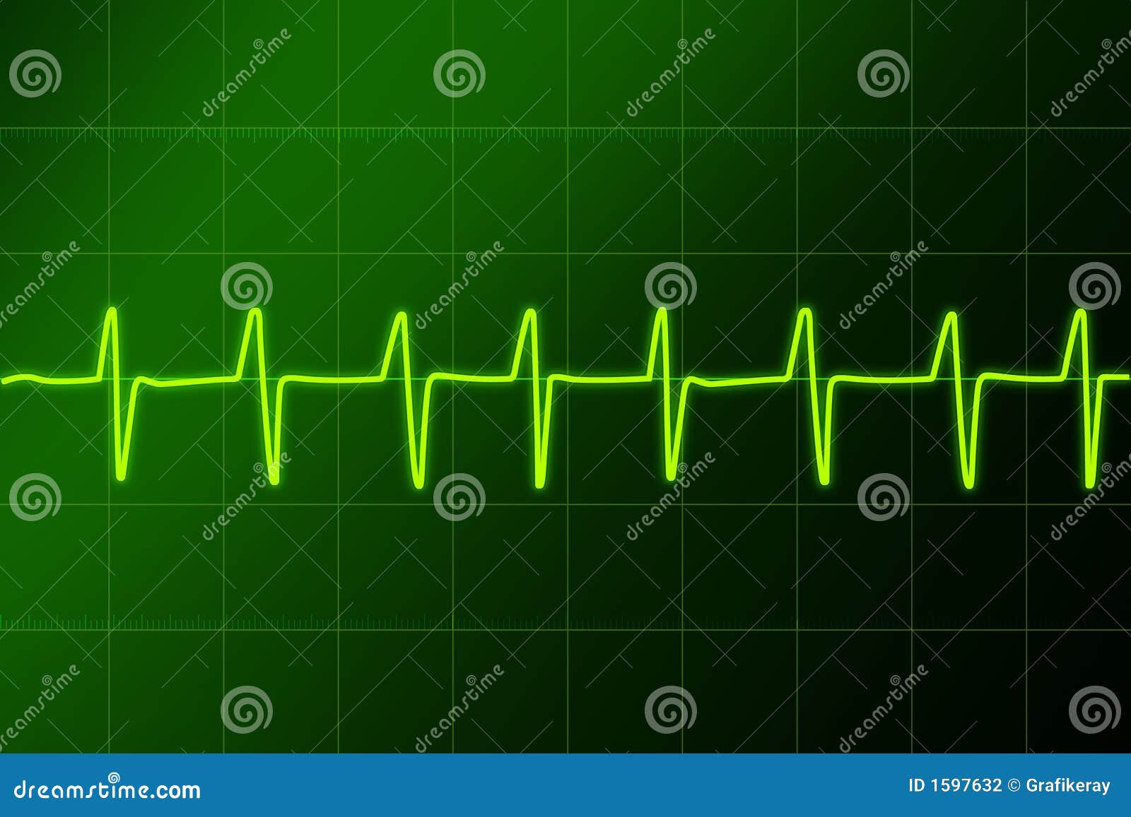 Cardiogram ritm stock illustration. Illustration of fall - 1597632