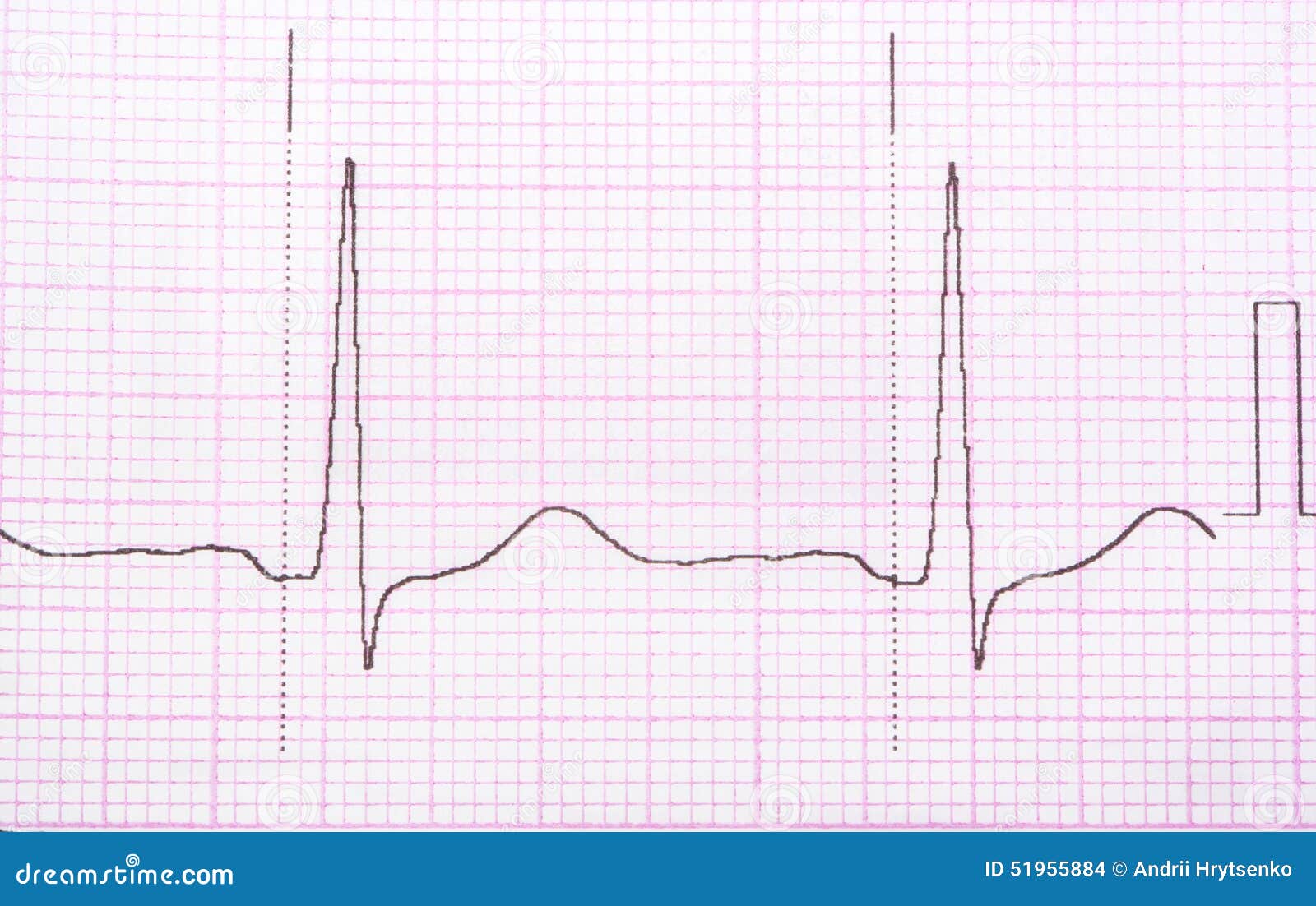 Cardiogram stock photo. Image of medicine, close, curve - 51955884