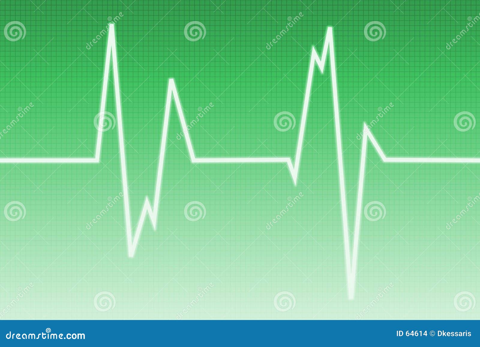 Cardiogram Wave - Radio Wave Stock Photo | CartoonDealer.com #64614