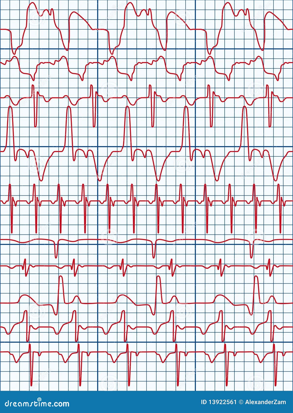 Cardiograma ilustración del vector. Ilustración de imagen - 13922561