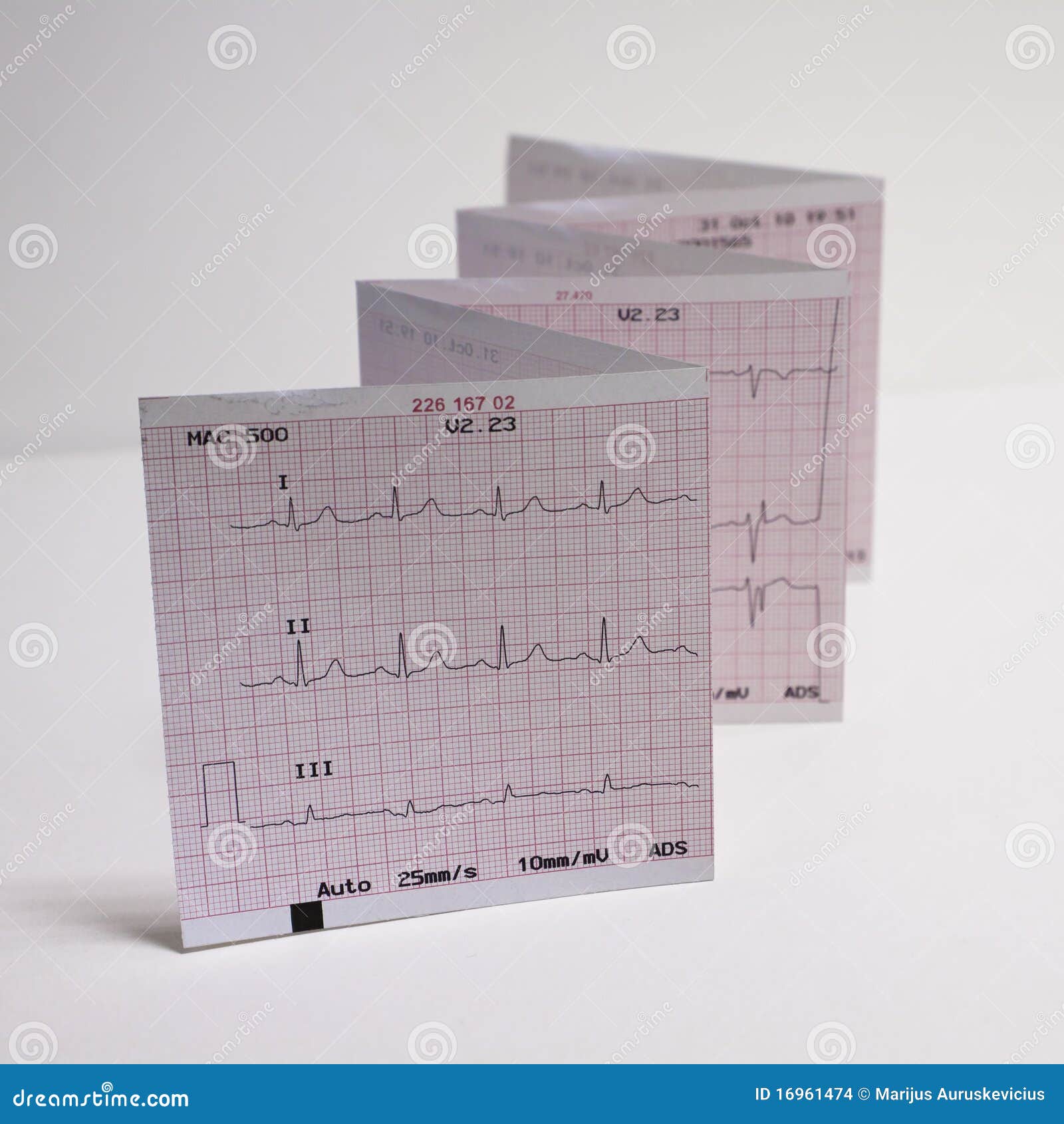 Cardiograma foto de archivo. Imagen de arteria, golpe - 16961474