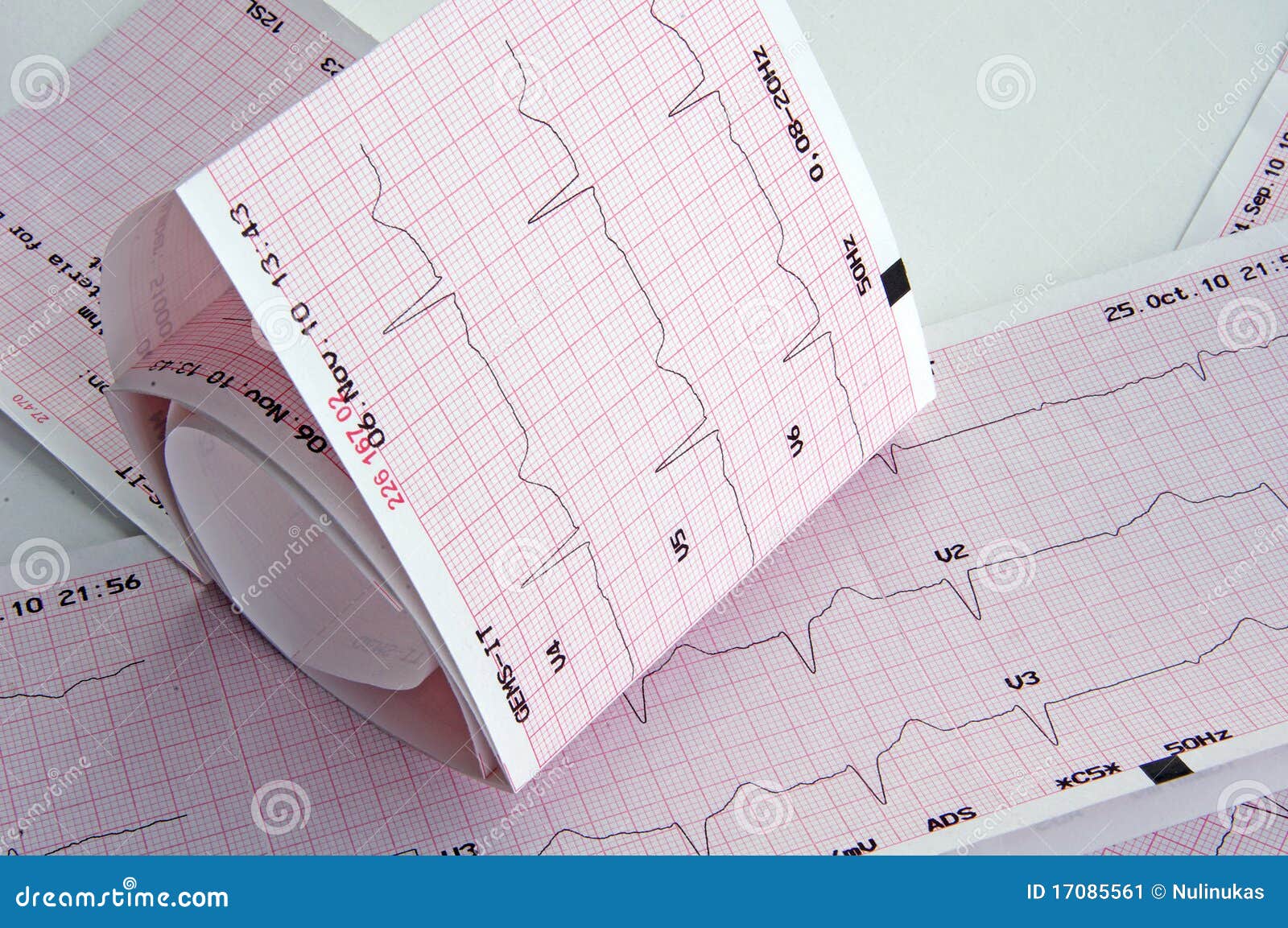 Cardiograma imagen de archivo. Imagen de diagnostique - 17085561