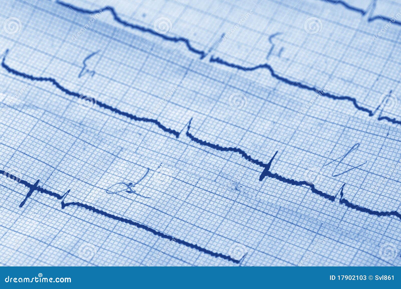 Cardiograma imagen de archivo. Imagen de medida, rastro - 17902103