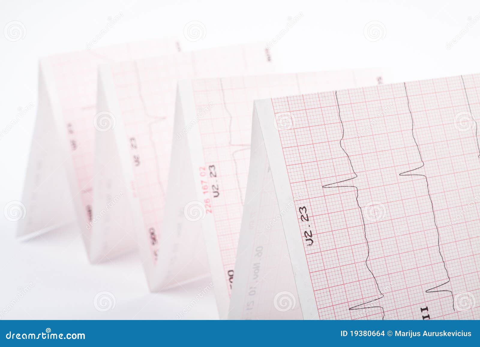 Cardiograma foto de archivo. Imagen de ataque, salud - 19380664