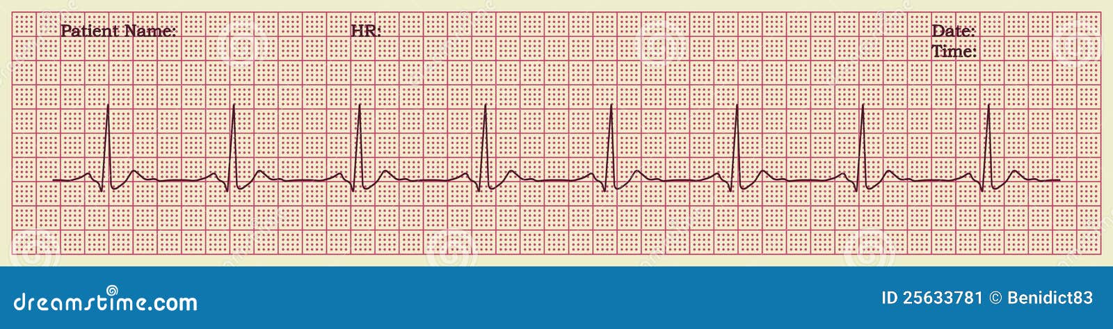 Cardiograma ilustración del vector. Ilustración de estilo - 25633781
