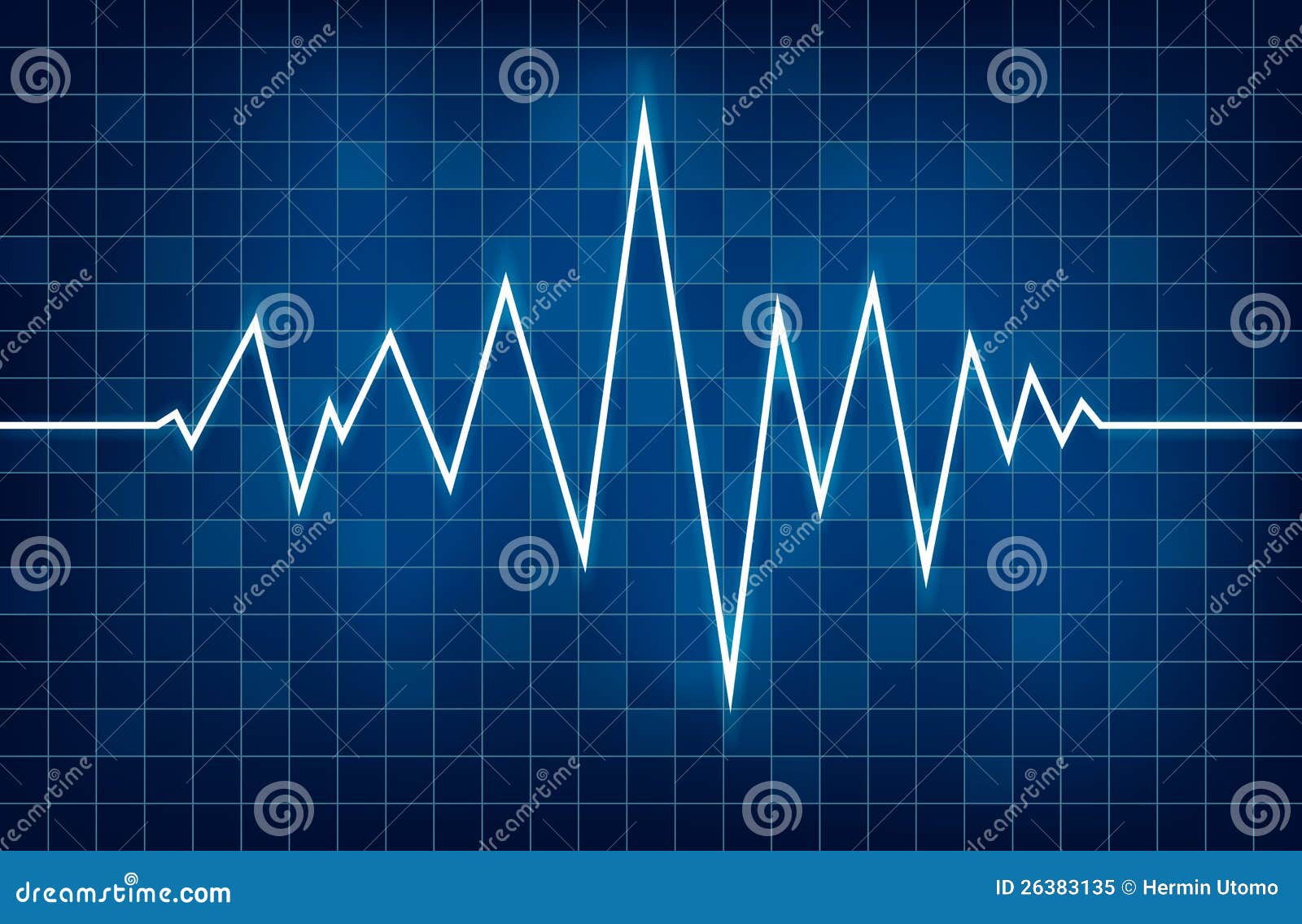 Cardiograma Foto de archivo libre de regalías - Imagen: 26383135