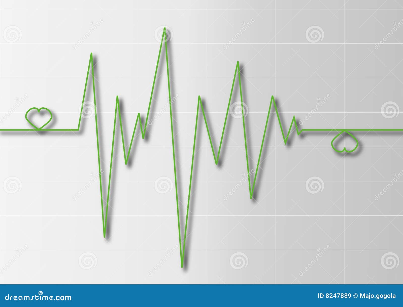 Cardiograma stock de ilustración. Ilustración de gris - 8247889