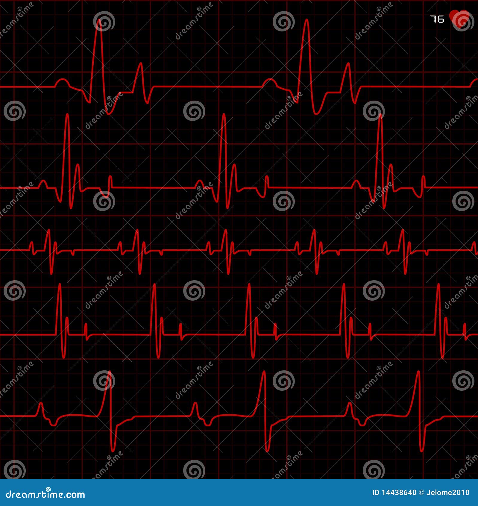 Cardiograma del vector ilustración del vector. Ilustración de muestra ...