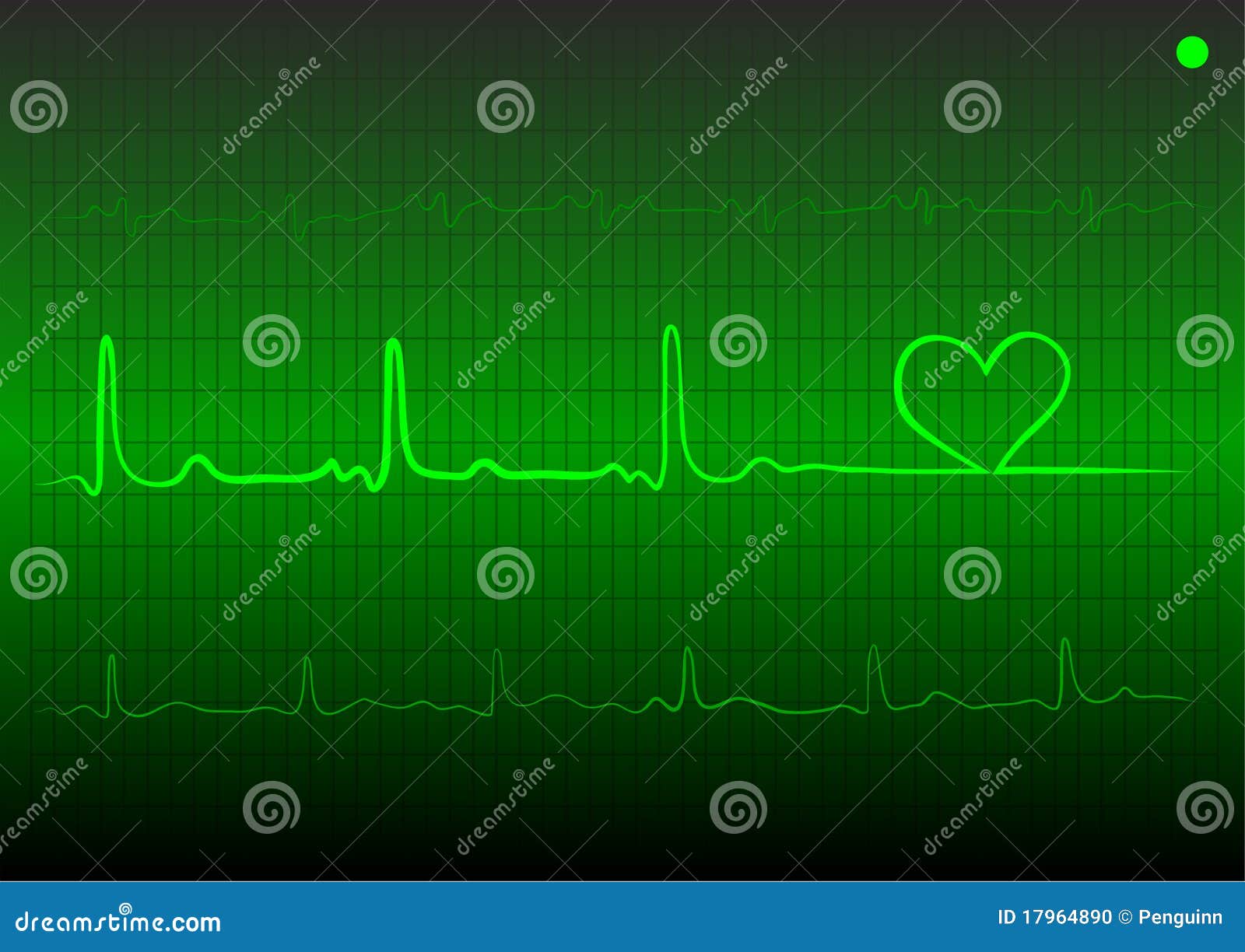 Cardiogramm illustration de vecteur. Illustration du onde - 17964890