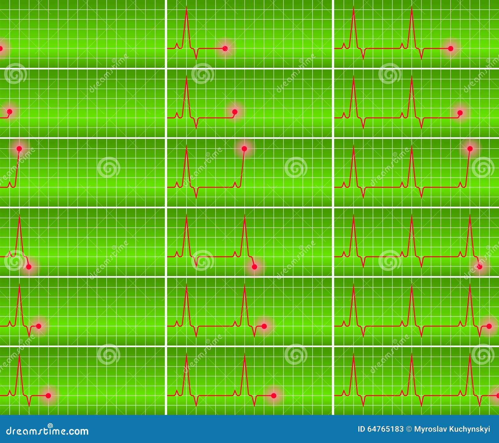 Cardiogramma Stabilito Di Vettore Illustrazione Vettoriale ...